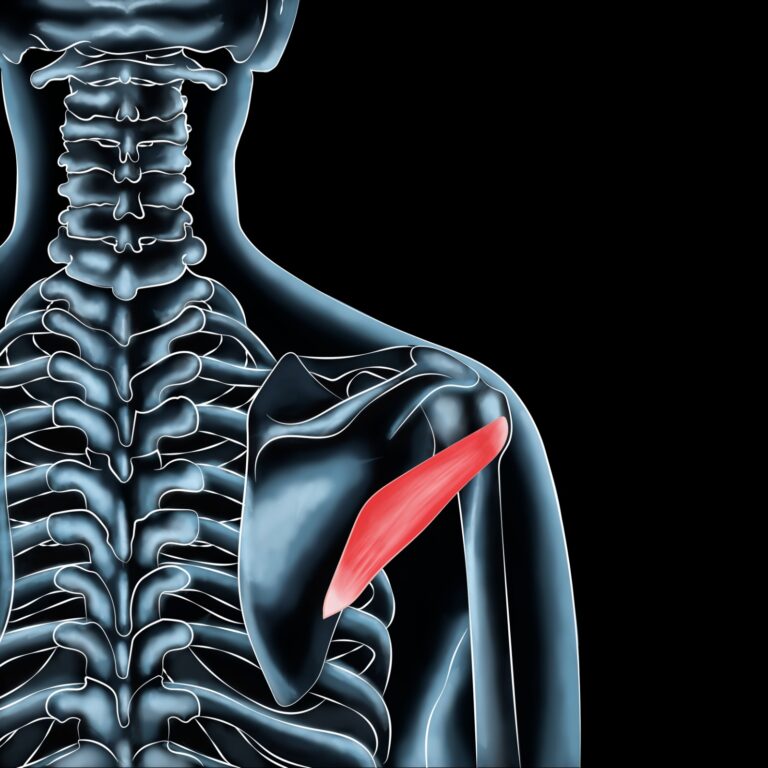 Effective Relief for Teres Minor Muscle Pain for Active People